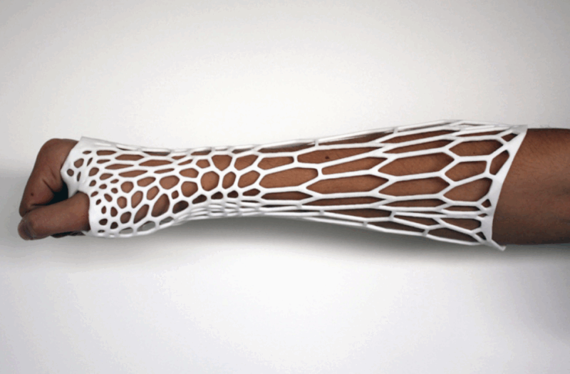 How Parametric Modeling Is Transforming Medical Devices